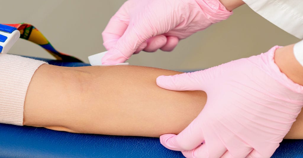 How Do Veins Collapse from Intravenous Drug Use? | On Call Treatment